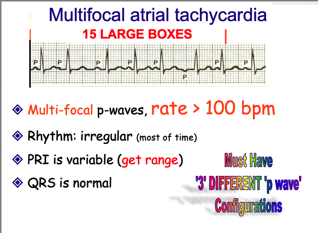 [P wave / atrial dysrhythmia ] 심방부정맥과 그에 따른 심전도의 ECG 변화/특징 : 네이버 블로그