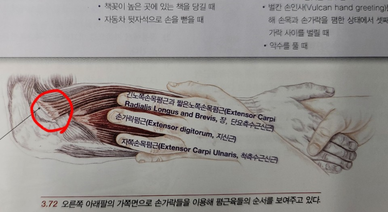 팔꿈치통증 테니스엘보우와 골프엘보우 네이버 블로그