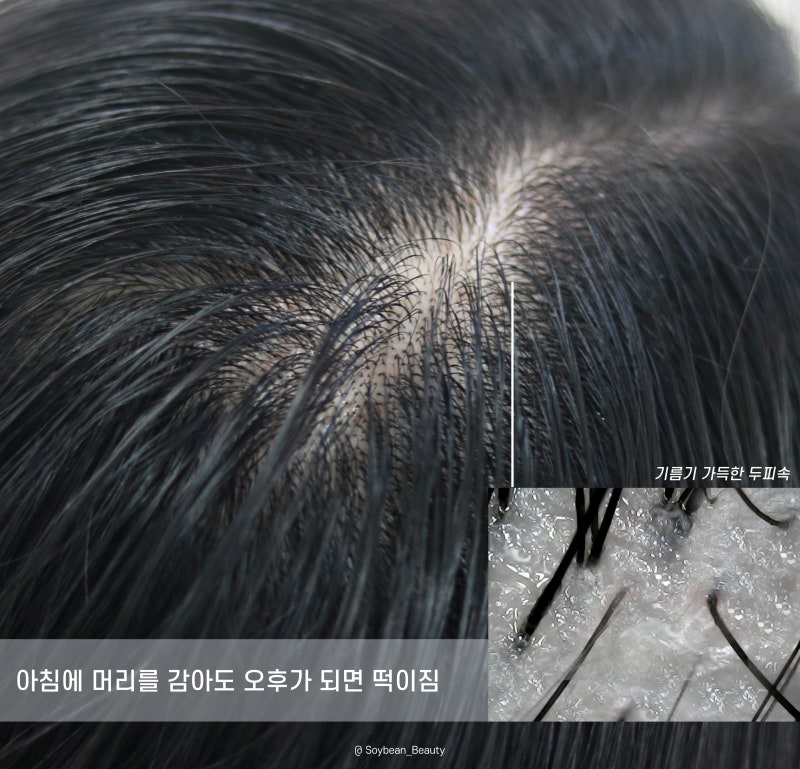 두피케어샴푸 깨끗하게 맑게 자신있게 네이버 블로그
