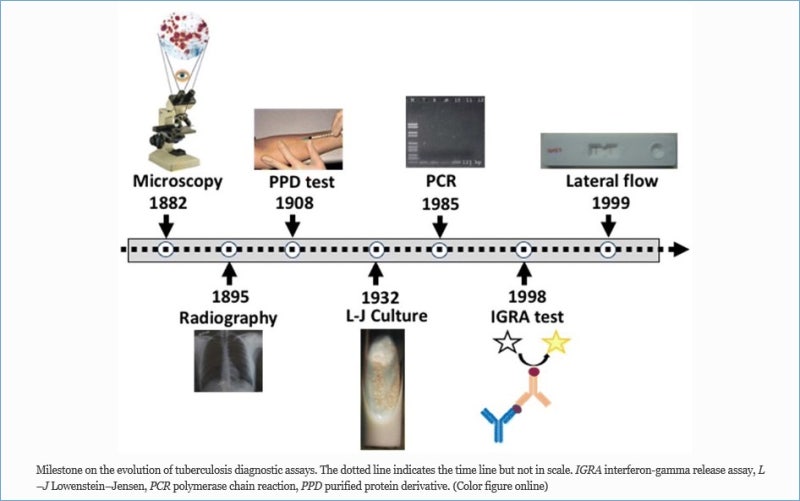 결핵 진단검사 : AFB Stain, Smear, Culture, PCR, IGRA, QTF : 네이버 블로그