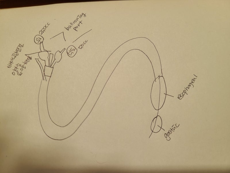 SB tube (sengstaken blackmore tube) 상스타켄 블레이크모어관 : 네이버 블로그