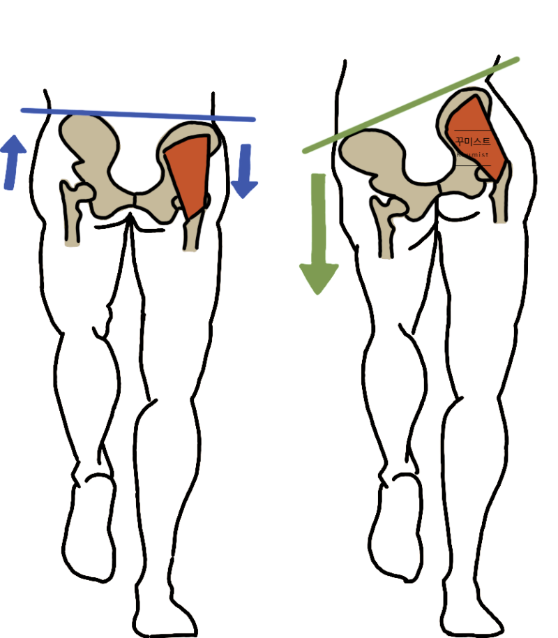 트렌델렌버그 자세 검사 Trendelenburg sign 징후 테스트 고관절 외전근(벌림근/hip abductor) 기능 ...