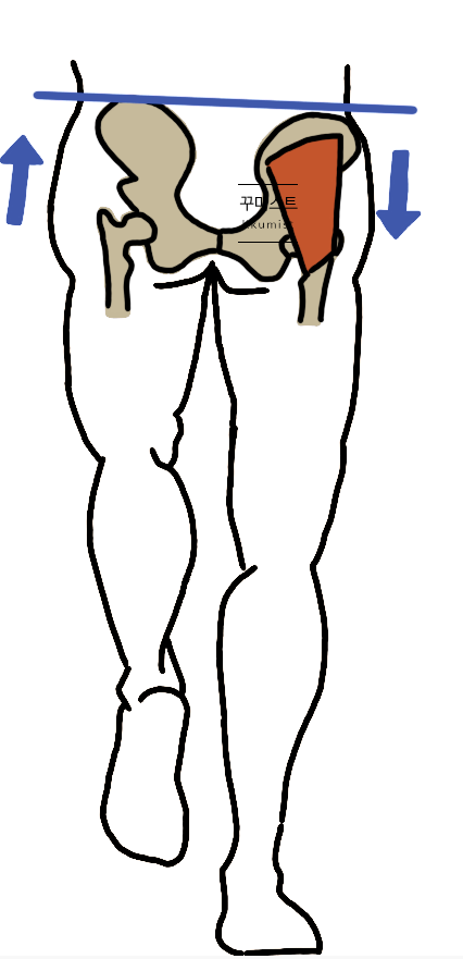 트렌델렌버그 자세 검사 Trendelenburg sign 징후 테스트 고관절 외전근(벌림근/hip abductor) 기능 ...