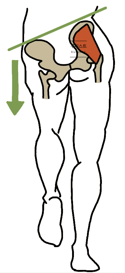 트렌델렌버그 자세 검사 Trendelenburg sign 징후 테스트 고관절 외전근(벌림근/hip abductor) 기능 ...
