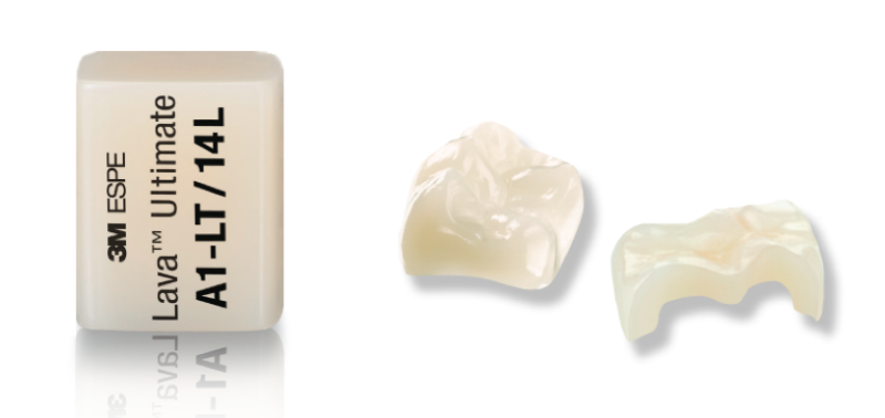 Lava Ultimate 블록 / 라바 얼티메이트 / 세라믹 : 네이버 블로그