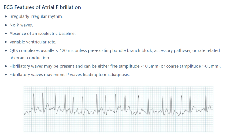 [심전도/EKG] 심방세동 A-fib CVR, RVR, SVR : 네이버 블로그