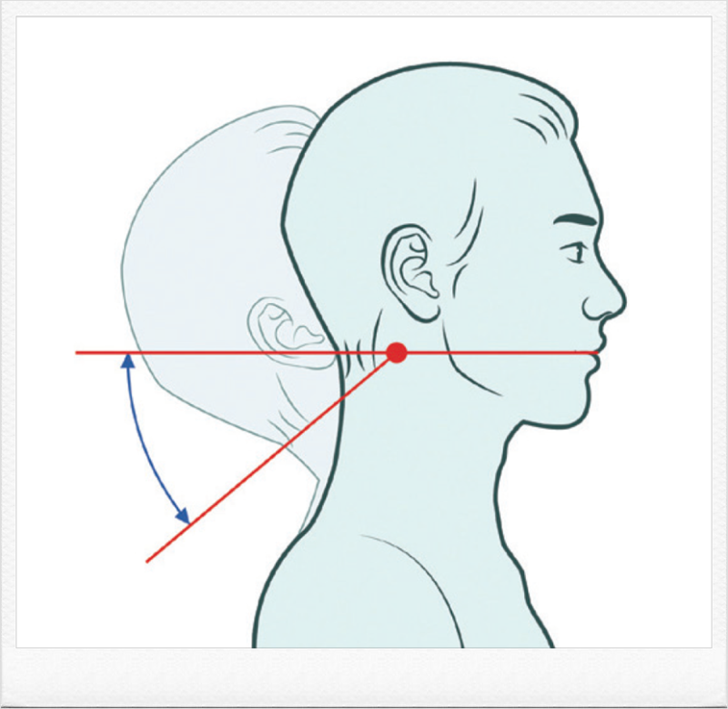 해부학 근육학 뒤통수밑근육 아래머리빗근하두사근ㆍobliquus Capitis Inferior 네이버 블로그
