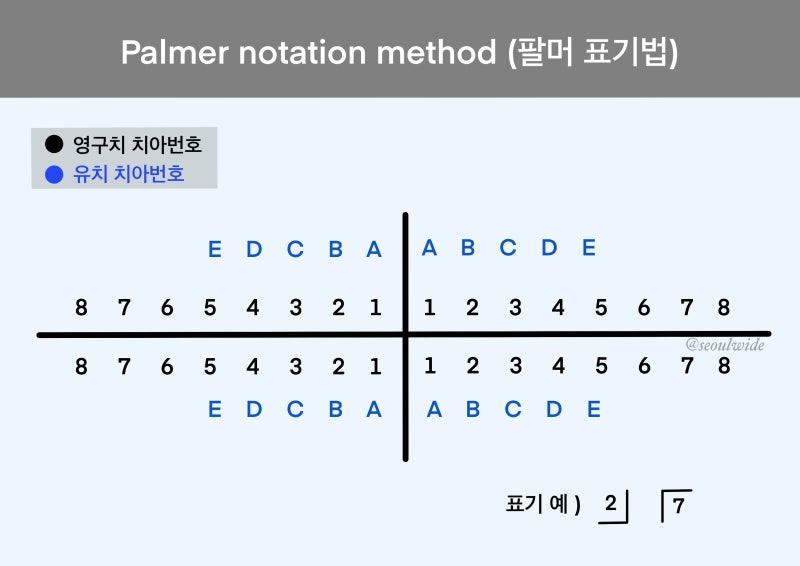 치아 번호 (영구치, 유치) - FDI, Palmer 표기법 [암사동 치과] : 네이버 블로그