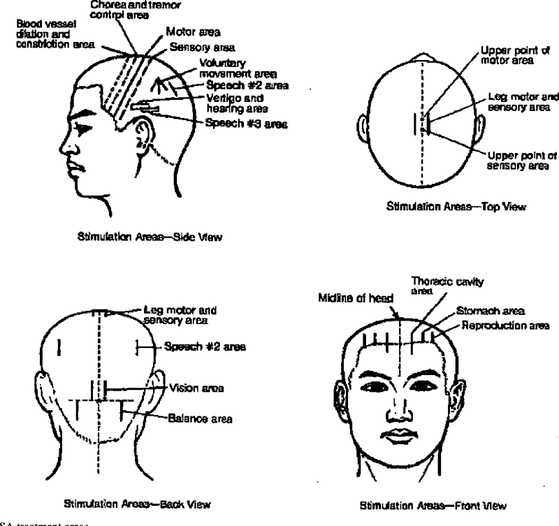 두침치료가 행동교육치료보다 자폐증 감소에 효과적이었다. : 네이버 블로그