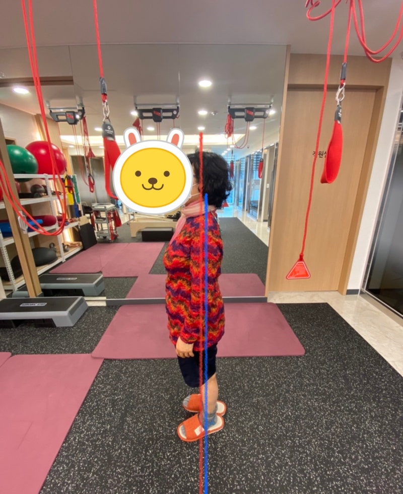 허리골반 통증, 체형교정 치료 케이스 스터디2 : 네이버 블로그