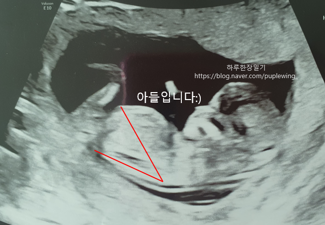 정보공유 태아성별구분방법 총정리 정확도 예측 네이버 블로그