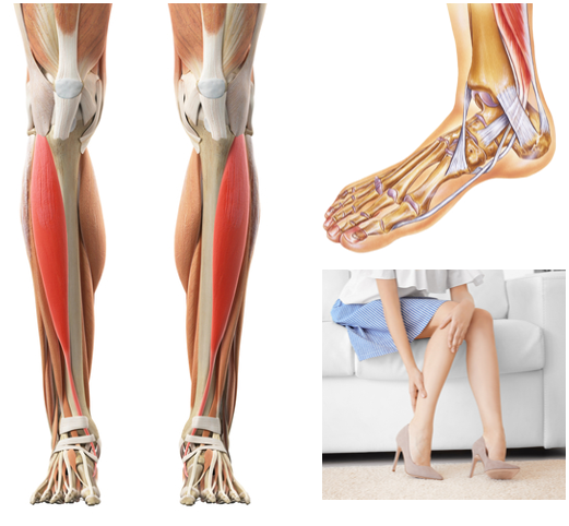 전경골근tibialis Anterior 정강이 앞쪽 통증 천안아산 달천한의원 네이버 블로그