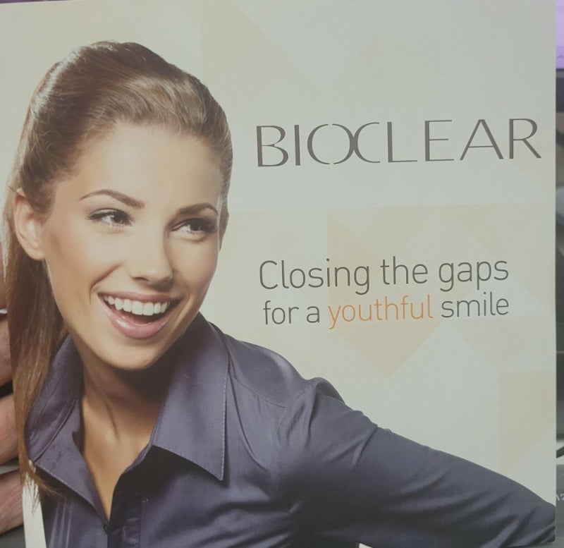 BIOCLEAR matrix system - Anterior matrix kit (바이오클리어 매트릭스) : 네이버 블로그