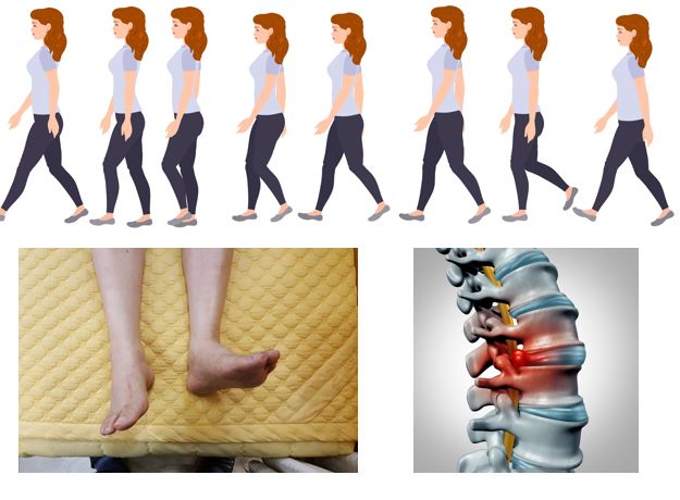 전경골근tibialis Anterior 정강이 앞쪽 통증 천안아산 달천한의원 네이버 블로그