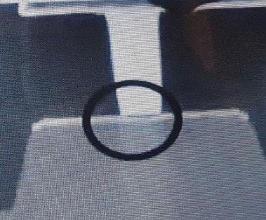 식각 #11. Etch 불량사례 : 네이버 블로그