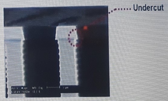 식각 #11. Etch 불량사례 : 네이버 블로그
