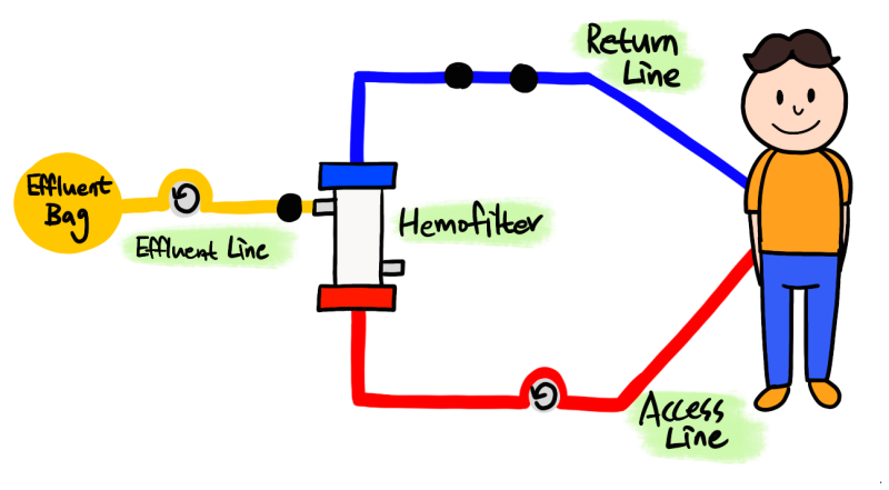 쉽게 이해하는 CRRT(Continuous Renal Replacement Therapy) : 네이버 블로그