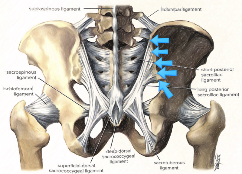 천장관절부전(scaroiliac joint dysfunction) - 을지로 자세굿 정형외과 : 네이버 블로그