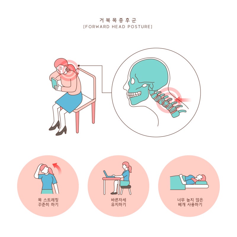 VDT 증후군 증상과 예방법, 대한안전교육협회가 알려드려요! : 네이버 블로그