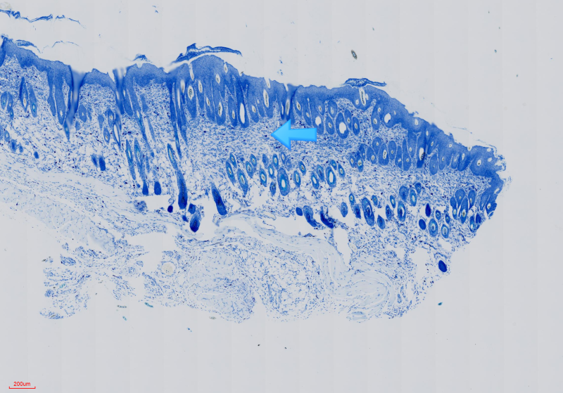 조직염색-Toluidine blue stain(톨루이딘블루염색) : 네이버 블로그