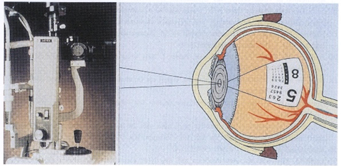 시력이란 무엇일까? - 시력정의, 시력측정, 시력환산, 안과시력검사 : 네이버 블로그