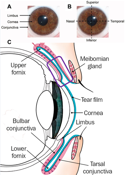 [EYE잘보여] 상윤부각결막염(Superior Limbic Keratoconjunctivitis; SLK) - 정의, 발병기전 ...