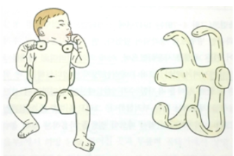 엉덩관절 보조기 : 네이버 블로그