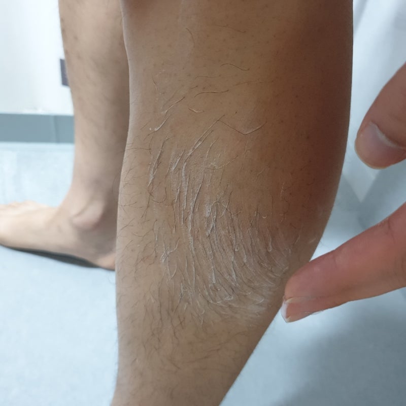 환절기바디로션 Ph55약산성 약국바디로션 파마라인 센스티브 네이버 블로그