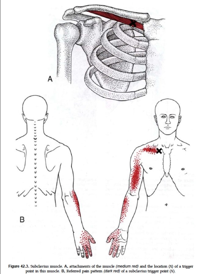 쇄골하근_빗장밑근(Subclavius) 기시, 정지, 작용, 스트레칭, 운동법 : 네이버 블로그