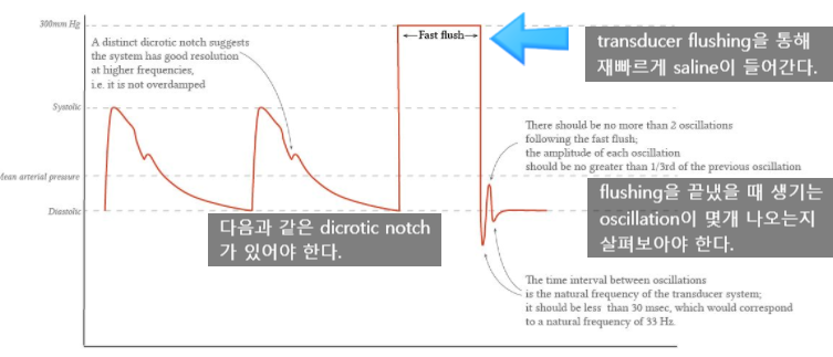 a-line(arterial line)의 모든 것(2)- square wave test, overdamping ...