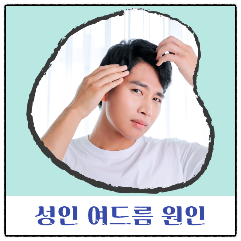 성인 이마 여드름 원인 및 없애는 법 인셀덤 화장품 네이버 블로그