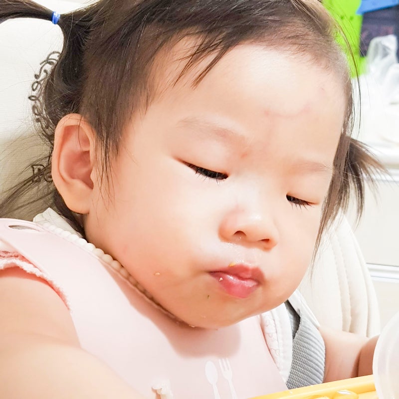 아기 머리 부딪힘 유아 뇌진탕 증상 체크 이마 혹 네이버 블로그