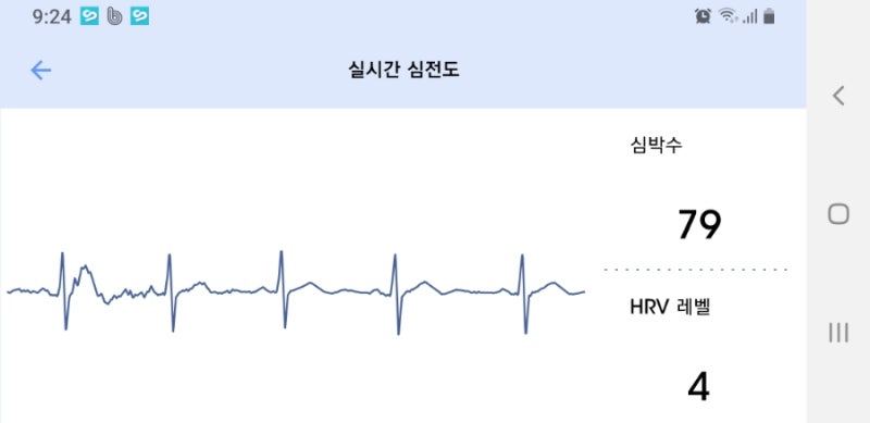 에스패취 S-PATCH EX 부정맥 및 심장질환 모니터링 : 네이버 블로그