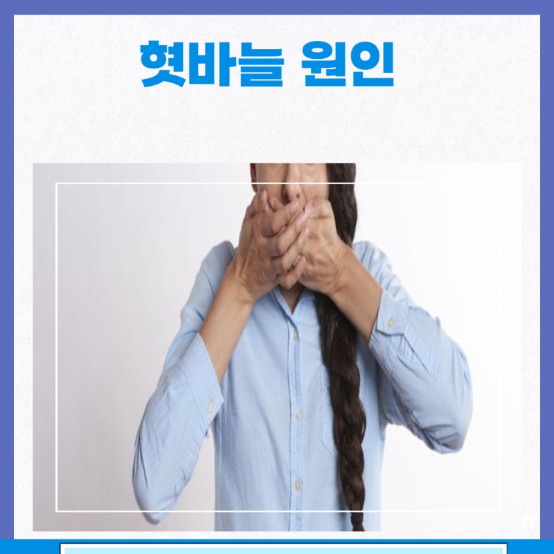 구내염 혓바늘 원인 혓바늘 없애는법 구내염 빨리 낫는법 네이버 블로그