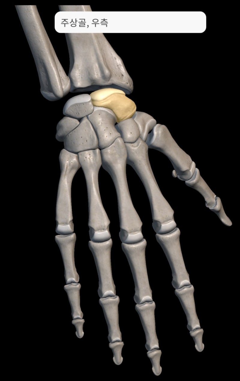 손목통증, 손목외측통증(Radial-Sided Wrist Pain), 주상골 인대손상(Scapholunate Ligament ...
