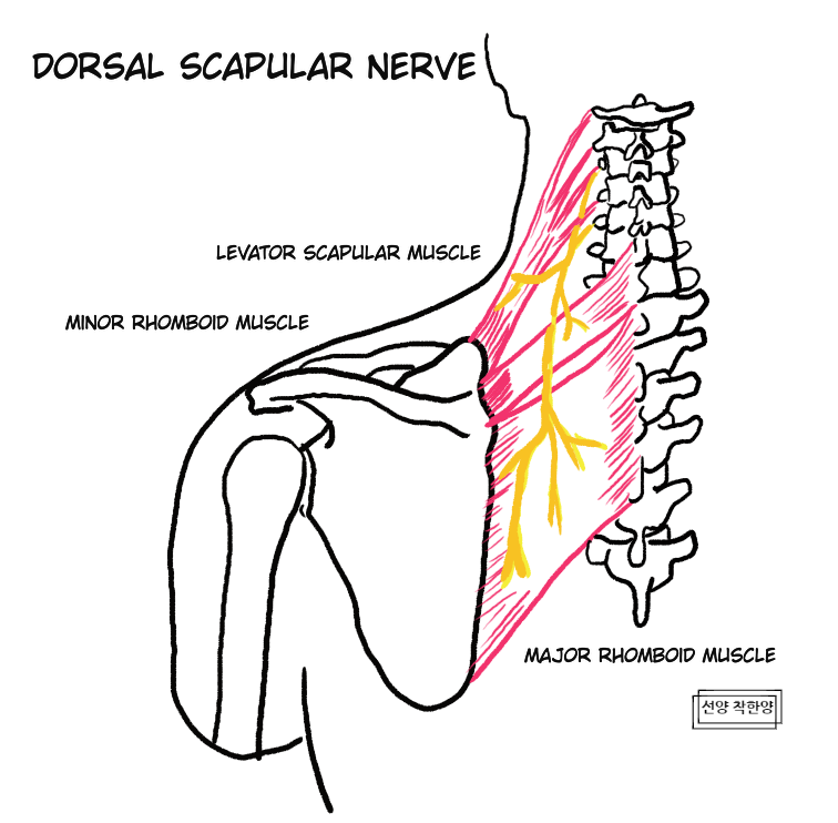 견갑배신경포착증후군 dorsal scapular nerve entrapment 증상 신경도수치료와 호흡 어깨 날개뼈 등 견갑통증 ...