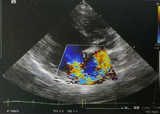 🫀 [수의학 적용] 개의 이첨판 폐쇄부전증(MMVD): 병태생리, 진단, 치료 가이드 : 네이버 블로그