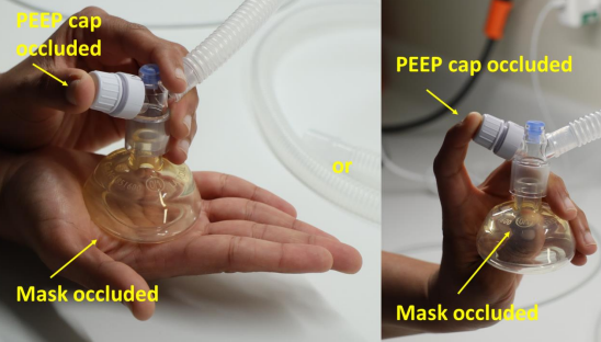 신생아 심폐소생술, neonatal resuscitation 에 관하여(2) - CPAP과 PPV(postive pressure ...