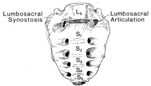 [요추] lumbosacral transitional vertebrae, Sacralization, Lumbarization ...