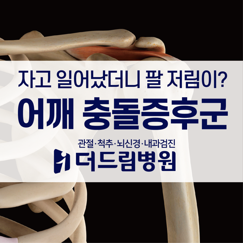 자고 일어났더니 팔 저림 어깨 충돌증후군을 의심하세요 강서구 정형외과 더드림병원 네이버 블로그