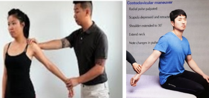 [경부]★Thoracic Outlet Syndrome(흉곽출구증후군) & 소흉근 증후군(pectoralis minor synd ...