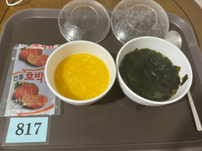 출산 후 뱃살 왜 안들어가개금백병원자연분만비용 아이사랑산후조리원 네이버 블로그