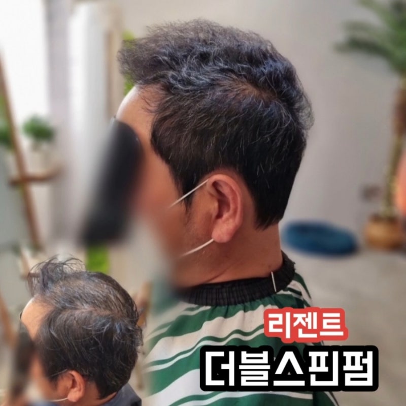 더블앤스핀 남자 탈모 펌 정수리탈모펌 M자탈모커버펌 뿌리스왈로 히든펌 네이버 블로그