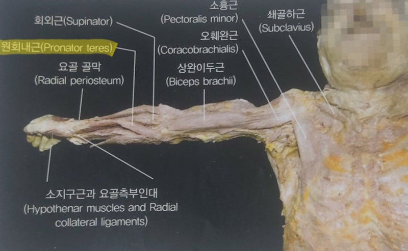 Pronator Teres 원회내근 원엎침근 Pronator Quadratus 방형회내근 네모엎침근 네이버 블로그