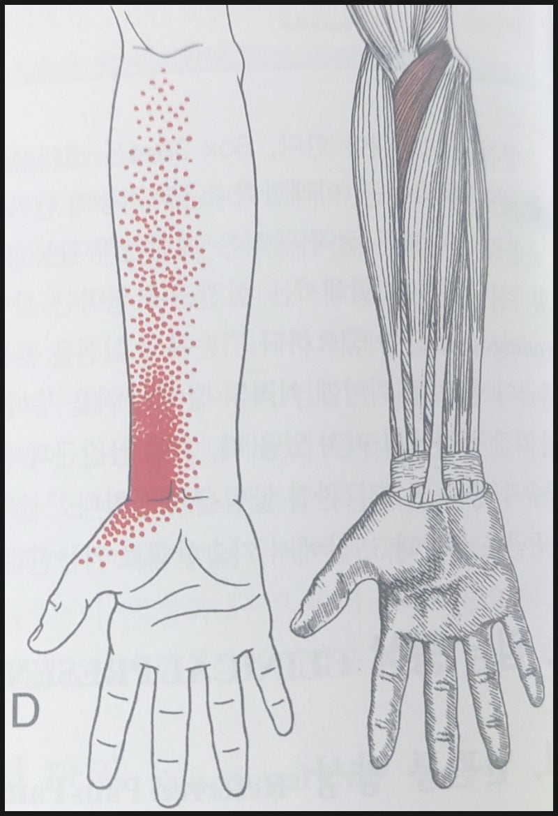 Pronator Teres 원회내근 원엎침근 Pronator Quadratus 방형회내근 네모엎침근 네이버 블로그