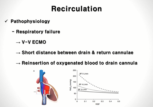 ECMO 기본이론_ ECMO mode 소개, 삽입 전후 간호, 모니터링, 합병증, weaning : 네이버 블로그