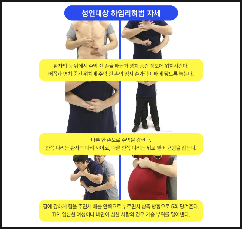 생명을 살리는 하임리히법 꼭 알아둡시다 기도폐쇄 응급처치 성인영아혼자서 셀프 하임리히 하는 법 네이버 블로그