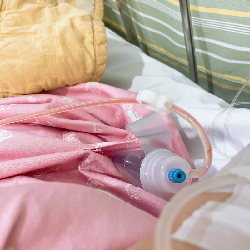 난소물혹증상 및 25cm 낭종 제거 수술 후기 네이버 블로그