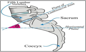 천골변위(sacrum torsion) : 네이버 블로그