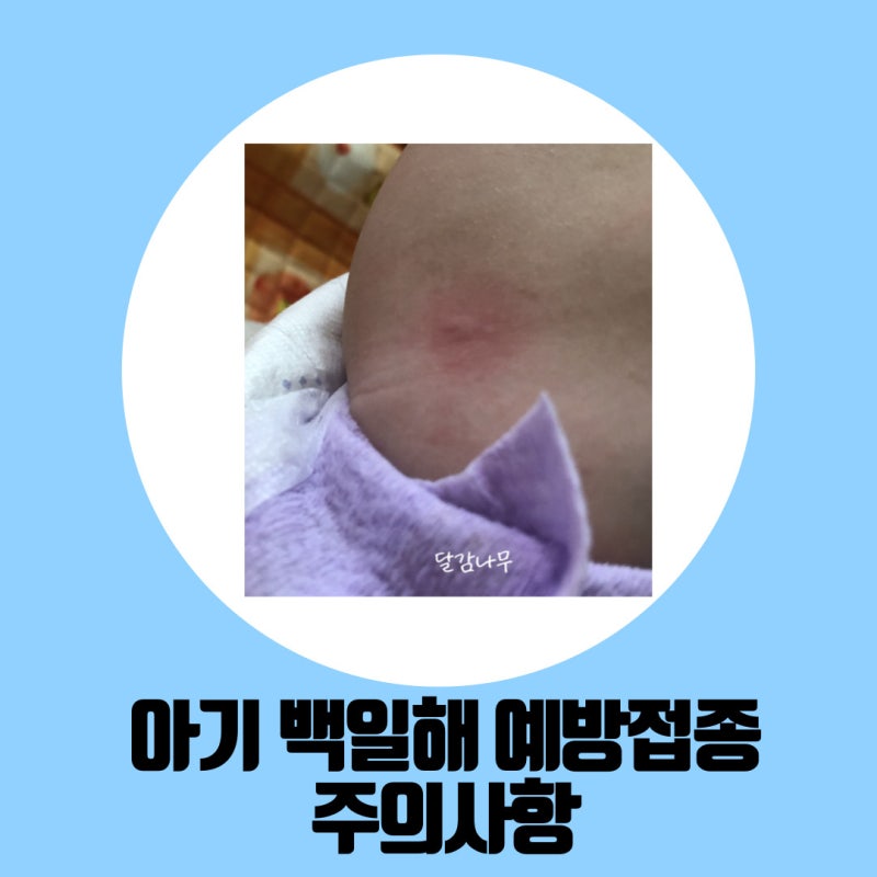 임산부 백일해 주사 예방접종 아기 백일해 백신 예방접종에 대한 모든것 네이버 블로그